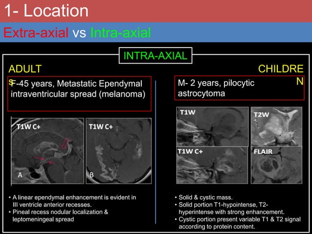 Normal & abnormal radiology of brain part iv | PPTX | Brain and Nervous ...