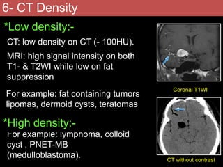 Normal & abnormal radiology of brain part iv | PPTX