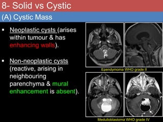 Normal & abnormal radiology of brain part iv | PPTX