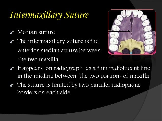 Normal anaomic radiolucencies/ dental implant courses