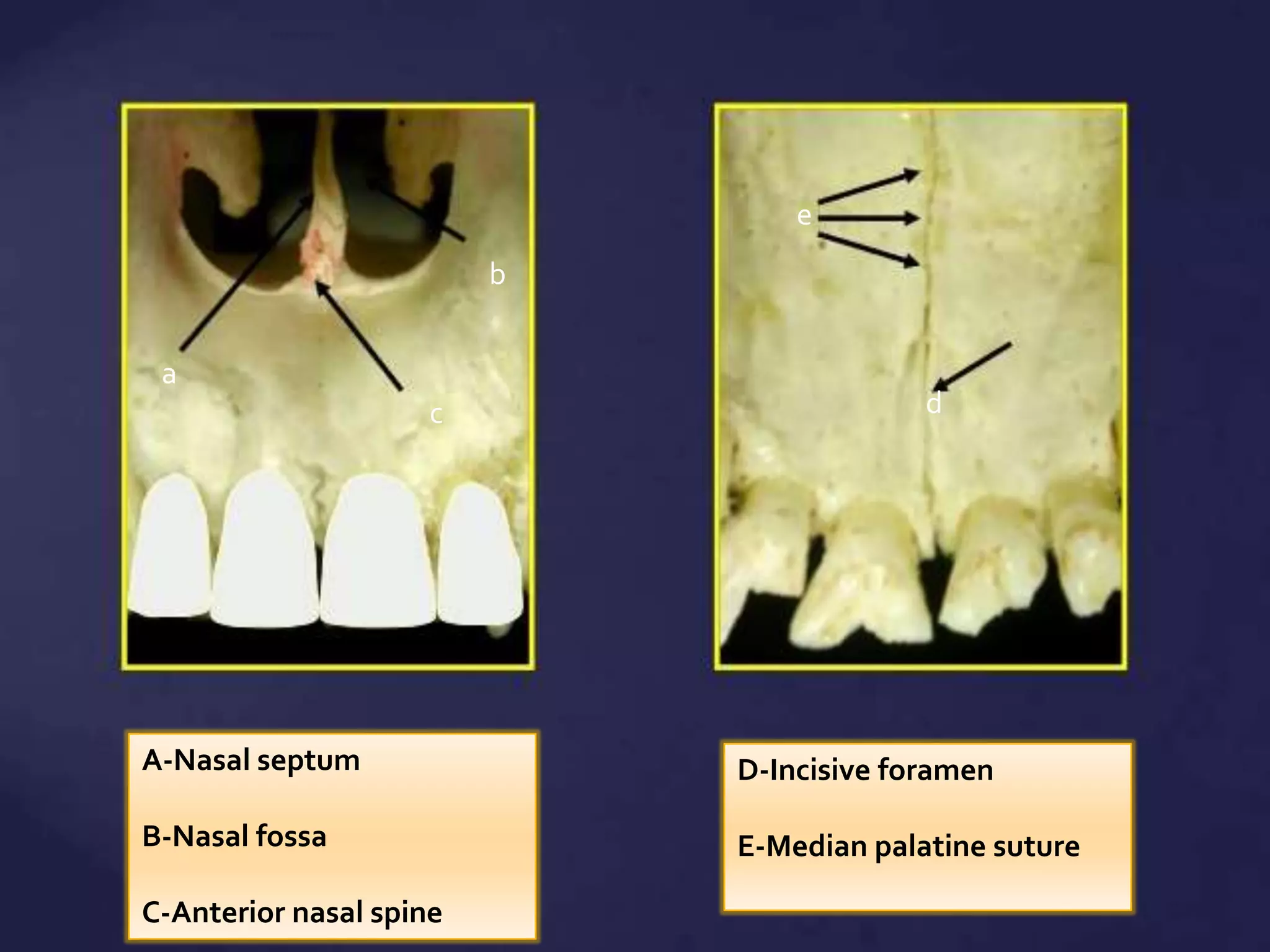 Normal Radiographic Anatomical Landmarks | PPTX