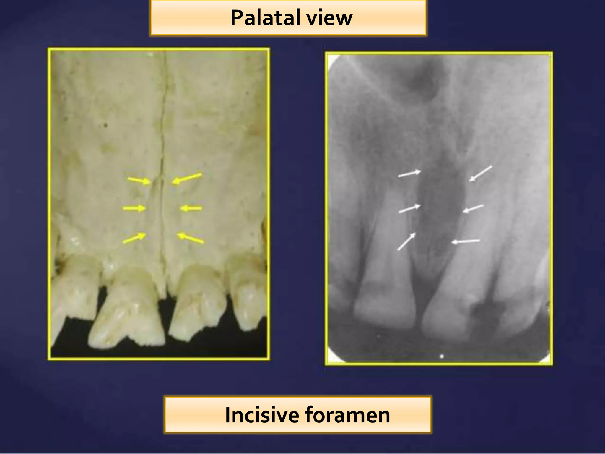 Normal Radiographic Anatomical Landmarks | PPTX