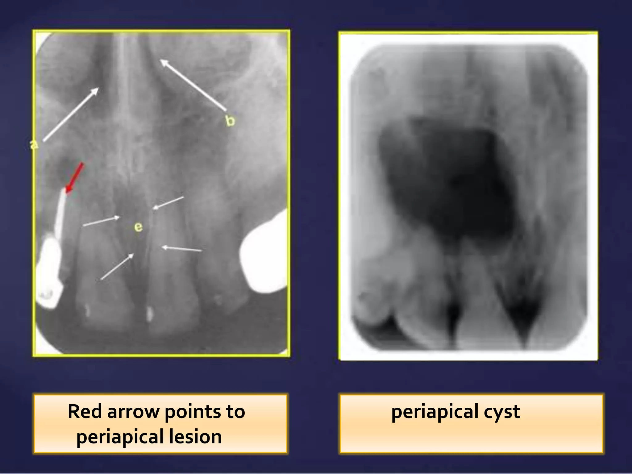 Normal Radiographic Anatomical Landmarks | PPTX