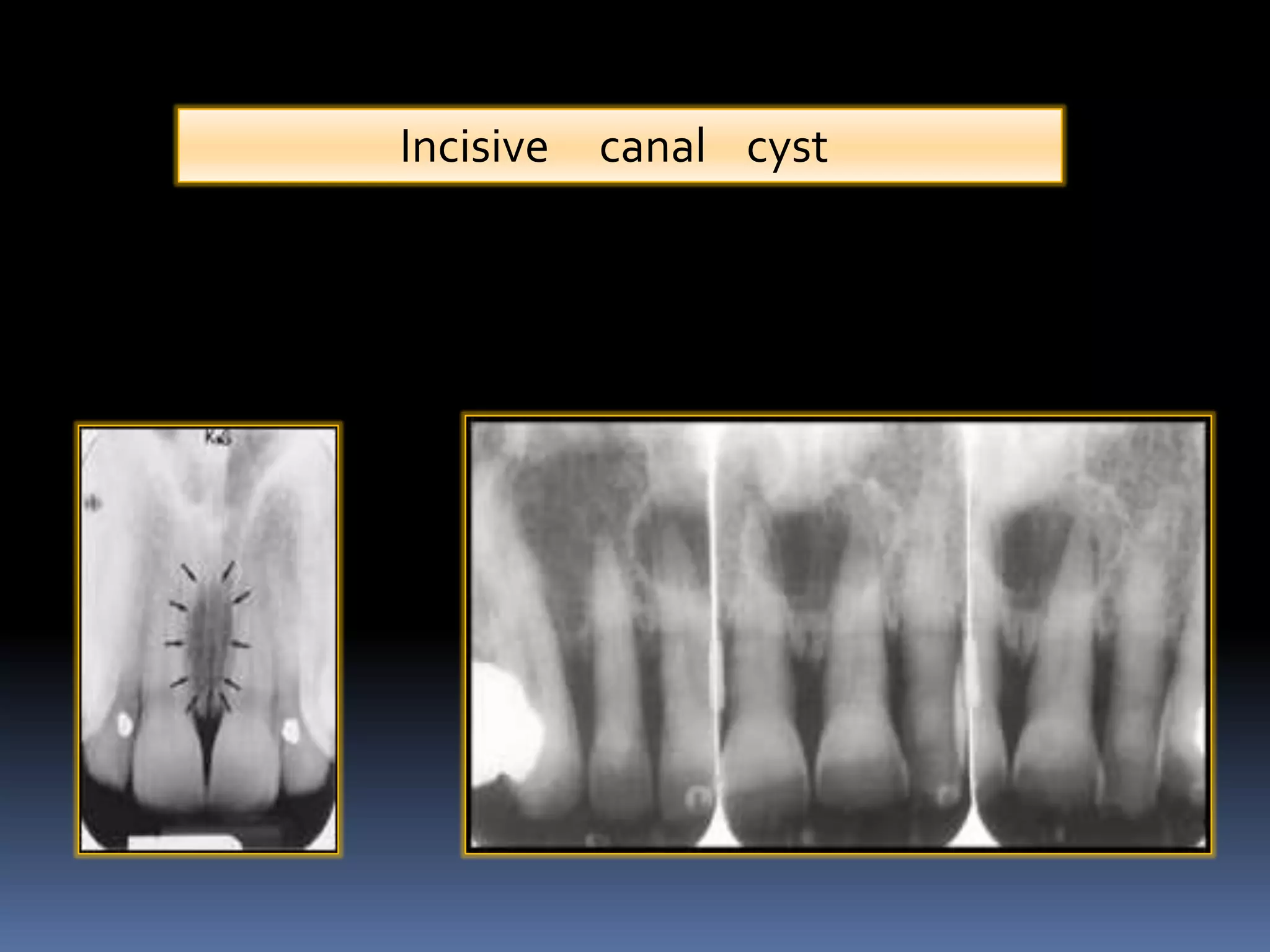 Normal Radiographic Anatomical Landmarks | PPTX