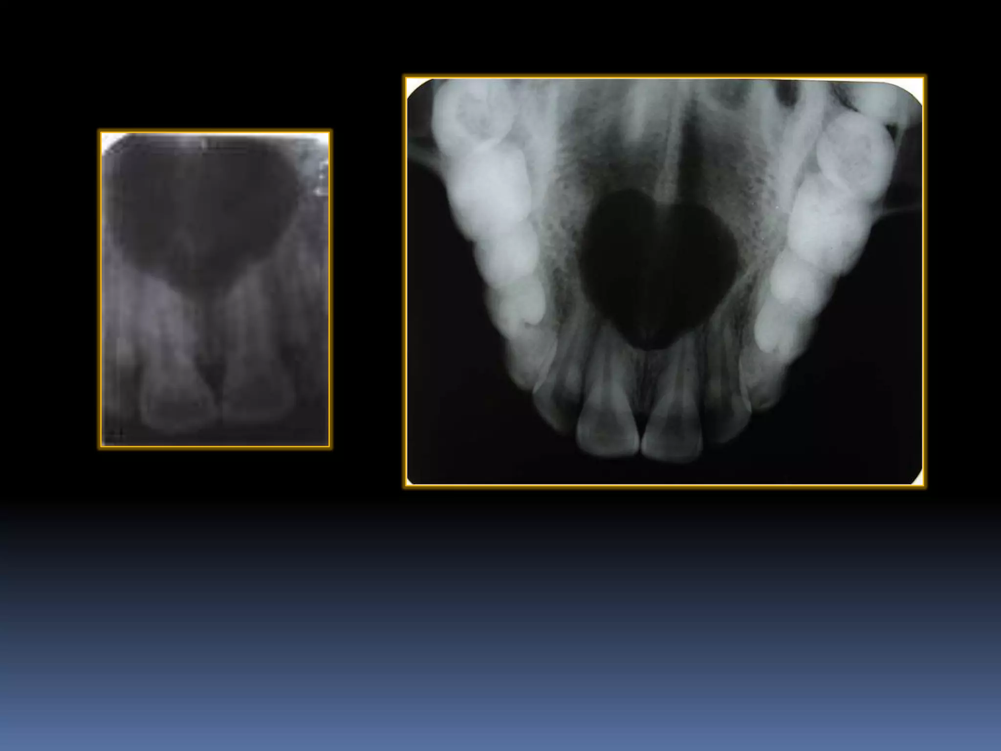 Normal Radiographic Anatomical Landmarks | PPTX