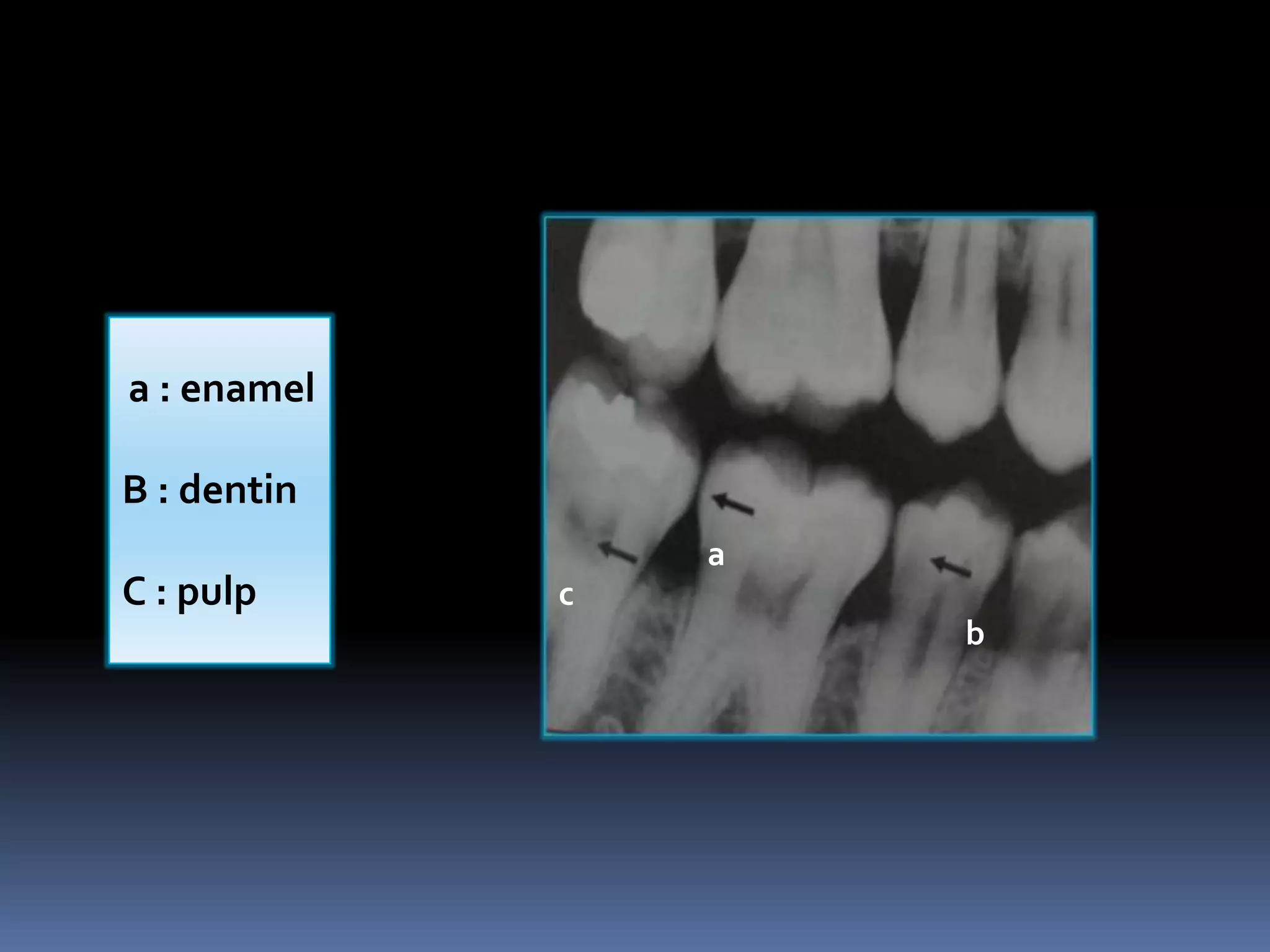 Normal Radiographic Anatomical Landmarks | PPTX