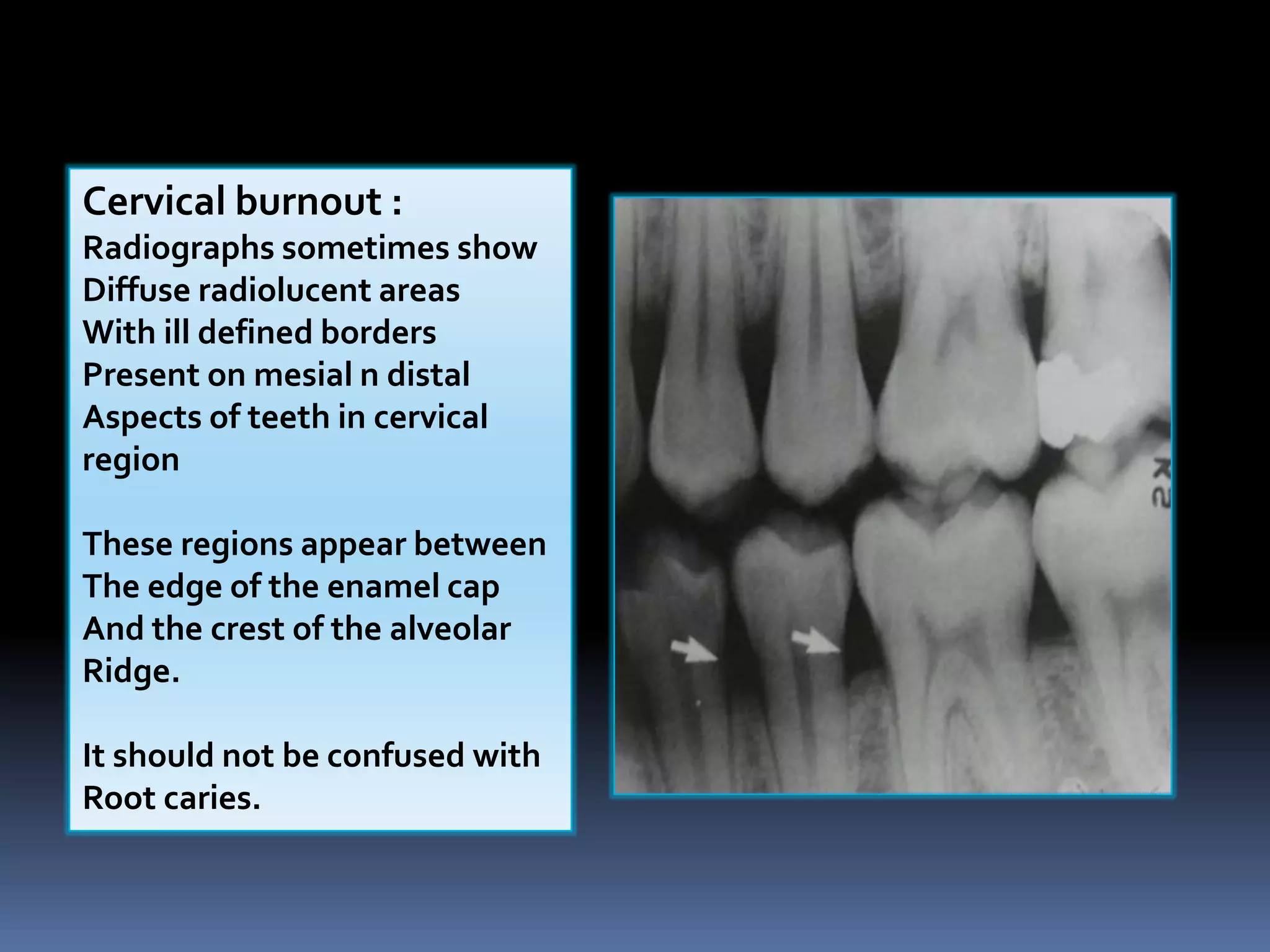 Normal Radiographic Anatomical Landmarks | PPTX