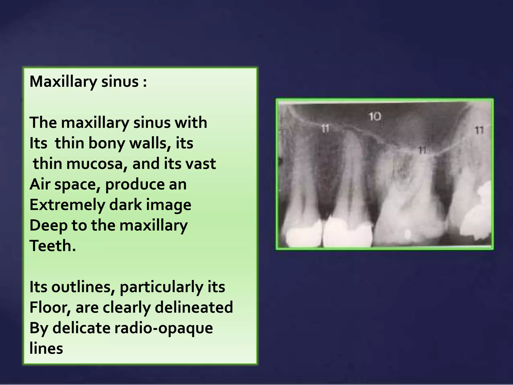 Normal Radiographic Anatomical Landmarks | PPTX