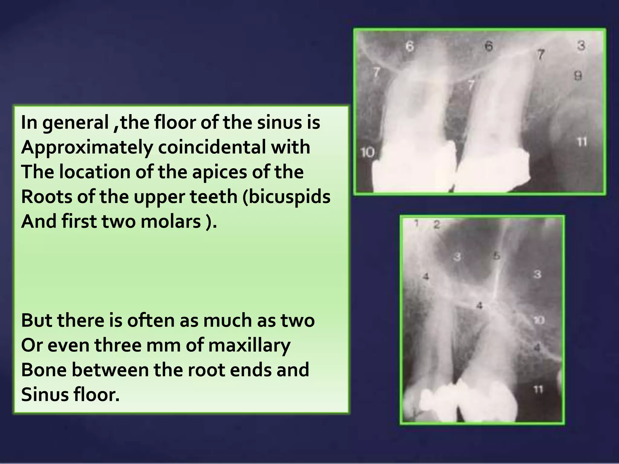 Normal Radiographic Anatomical Landmarks | PPTX