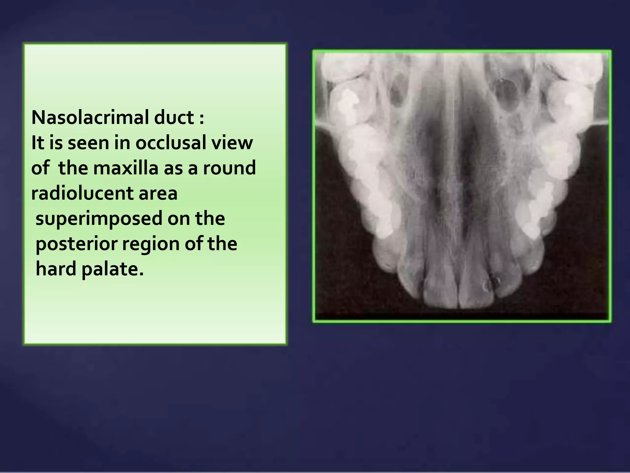 Normal Radiographic Anatomical Landmarks | PPTX