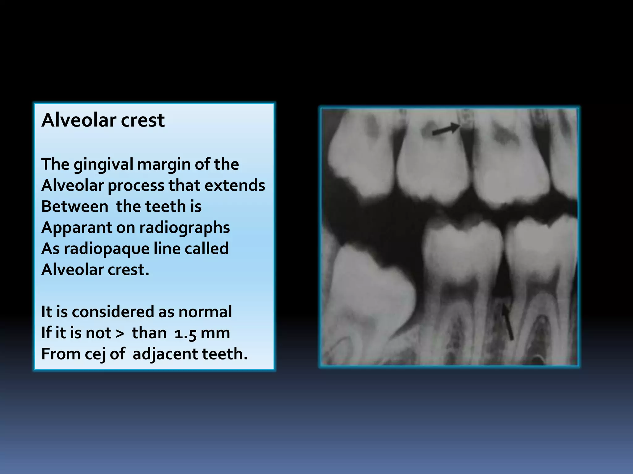 Normal Radiographic Anatomical Landmarks | PPTX