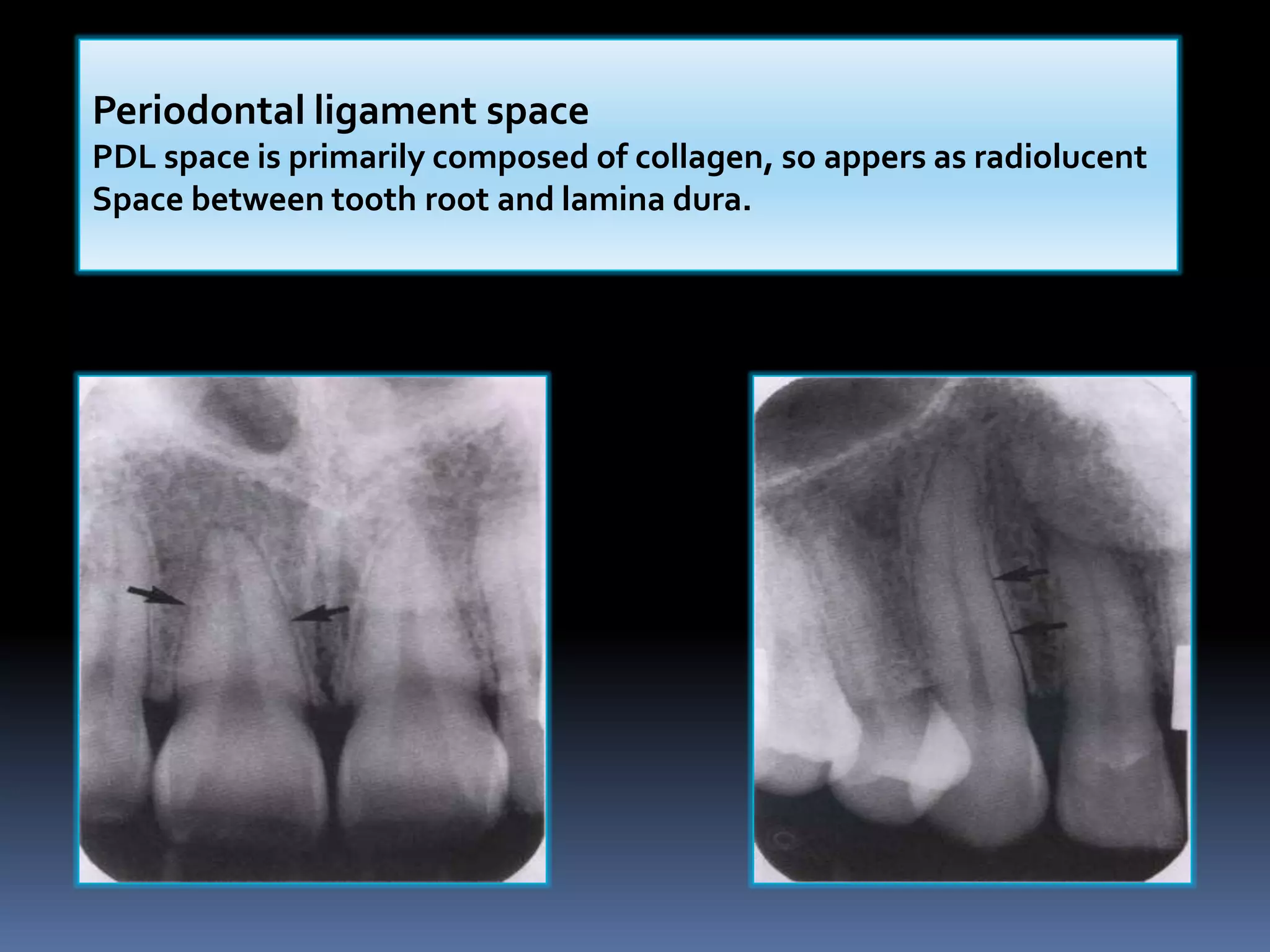 Normal Radiographic Anatomical Landmarks | PPTX