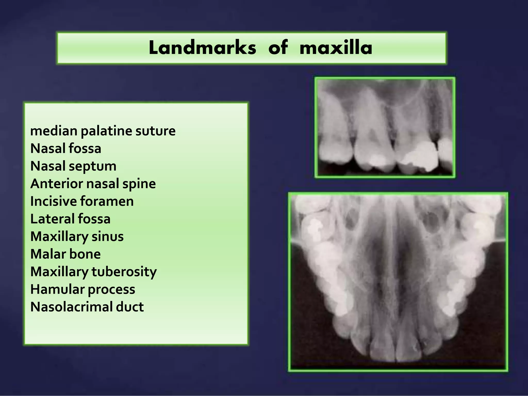 Normal Radiographic Anatomical Landmarks | PPTX