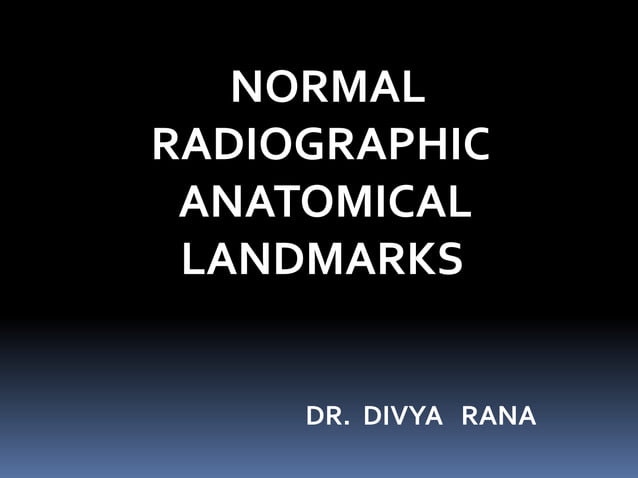Normal Radiographic Anatomical Landmarks | PPTX