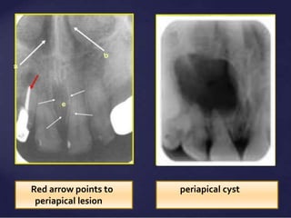 Normal Radiographic Anatomical Landmarks | PPTX