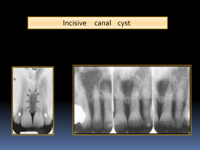 Normal Radiographic Anatomical Landmarks | PPTX