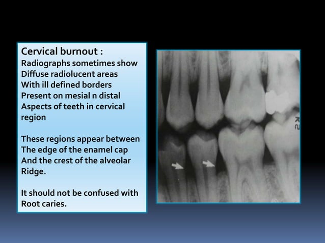 Normal Radiographic Anatomical Landmarks | PPTX
