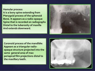 Normal Radiographic Anatomical Landmarks | PPTX