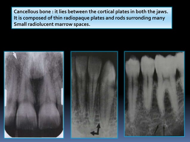 Normal Radiographic Anatomical Landmarks | PPTX