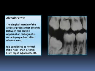 Alveolar Crest Radiograph