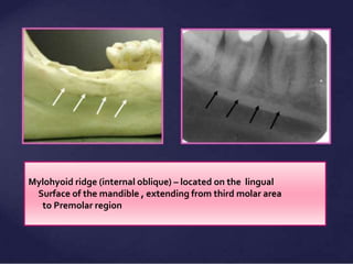 Mylohyoid Line Radiograph