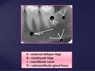 External Oblique Ridge Radiograph