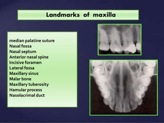 Hamular Process Radiography