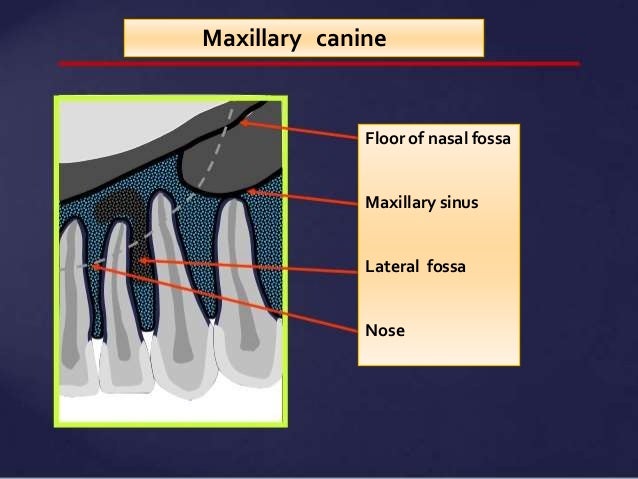 Normal Radiographic Anatomical Landmarks