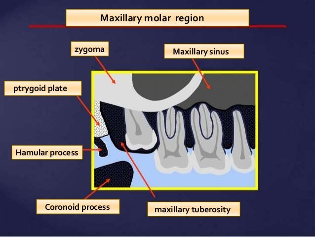Hamular Process Radiography
