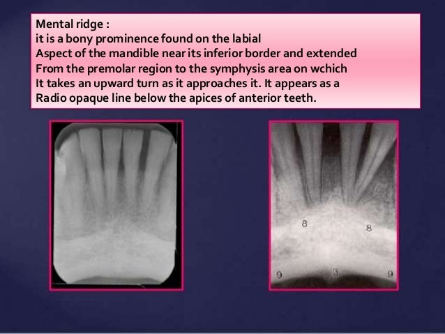 Normal Radiographic Anatomical Landmarks