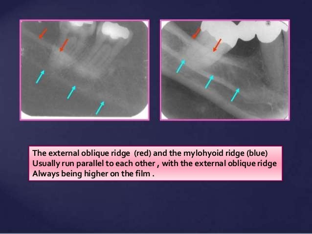 Normal Radiographic Anatomical Landmarks