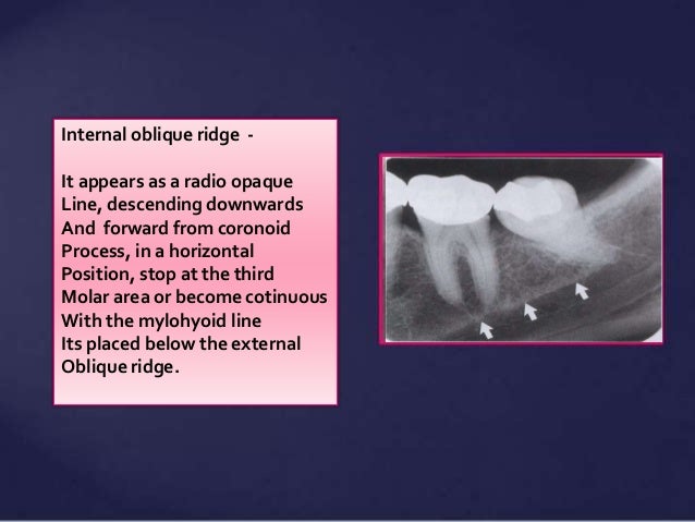 Normal Radiographic Anatomical Landmarks