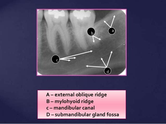 Normal Radiographic Anatomical Landmarks