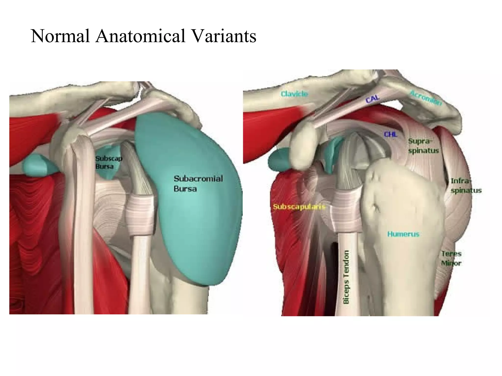 Normal anatomical variants | PPT