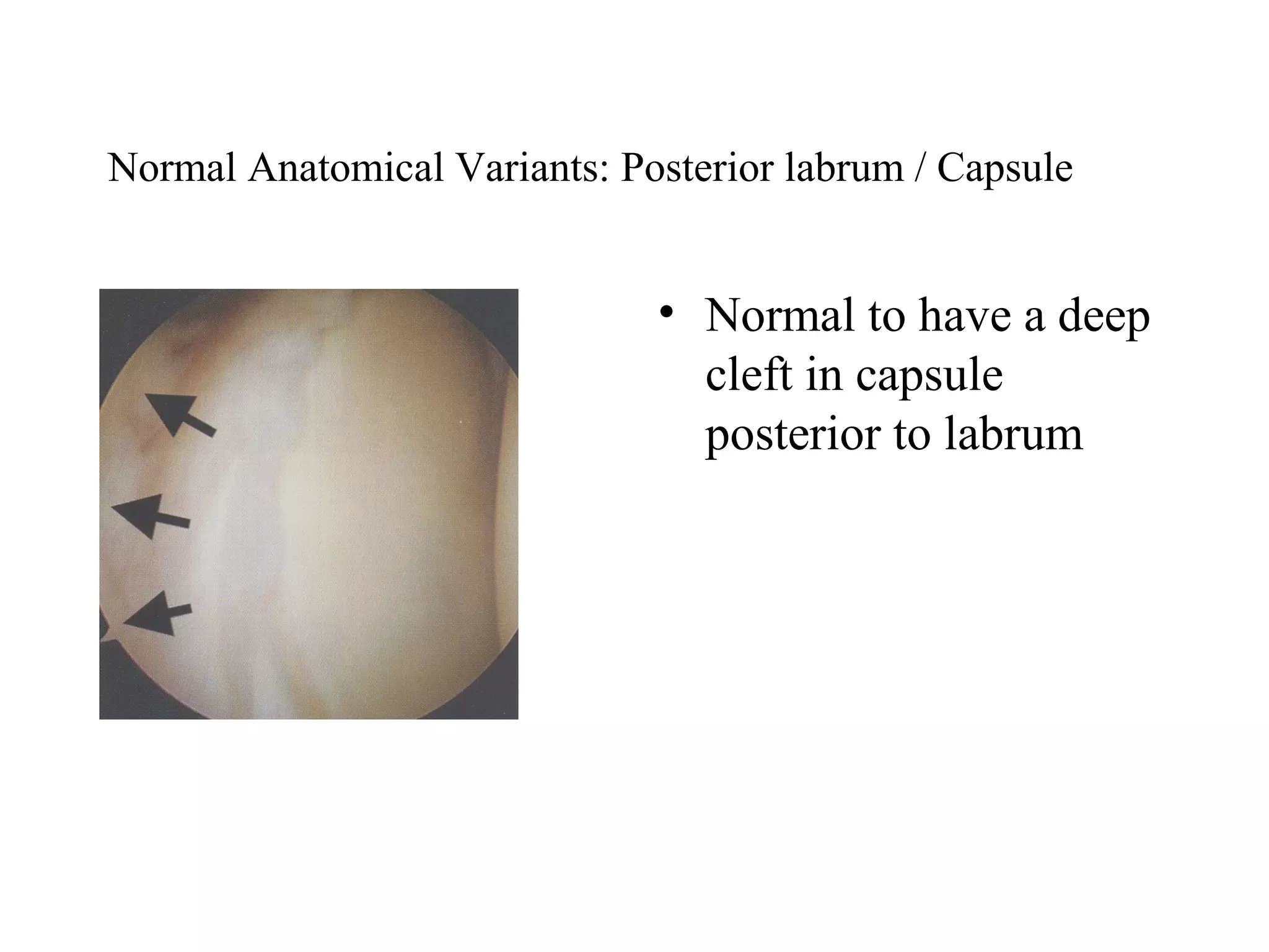 Normal anatomical variants | PPT