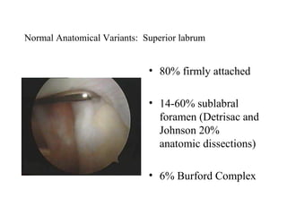 Normal anatomical variants | PPT