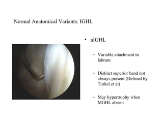 Normal anatomical variants | PPT