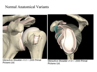 Normal anatomical variants | PPT