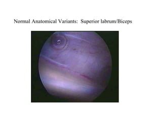 Normal anatomical variants | PPT