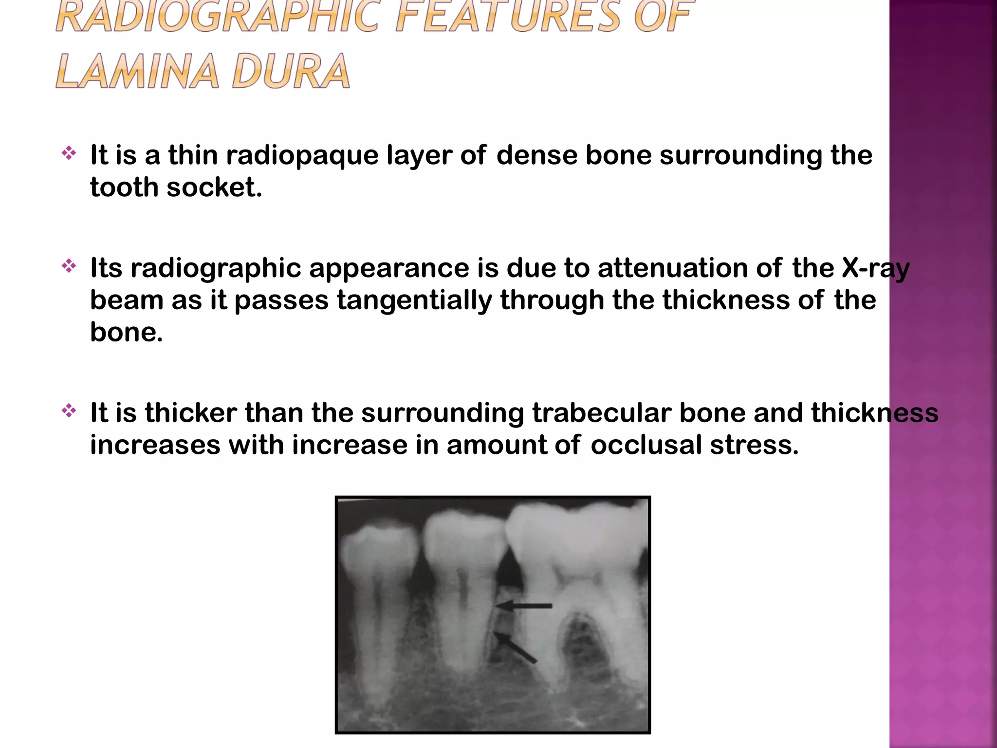 NORMAL ANATOMIC LANDMARKS ; PRICHARDS CRITERIA ; NORMAL INTERDENTAL ...