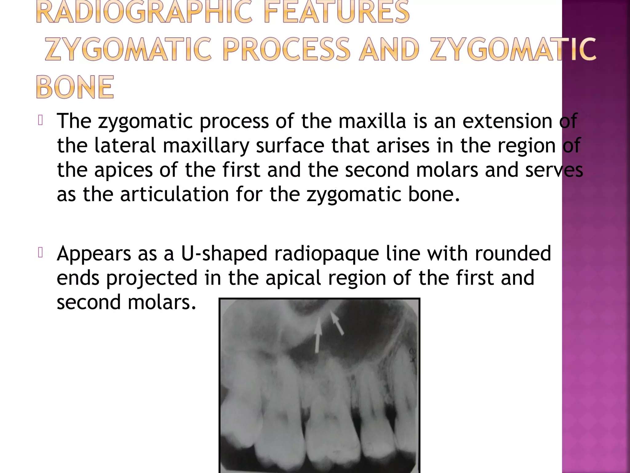 NORMAL ANATOMIC LANDMARKS ; PRICHARDS CRITERIA ; NORMAL INTERDENTAL ...