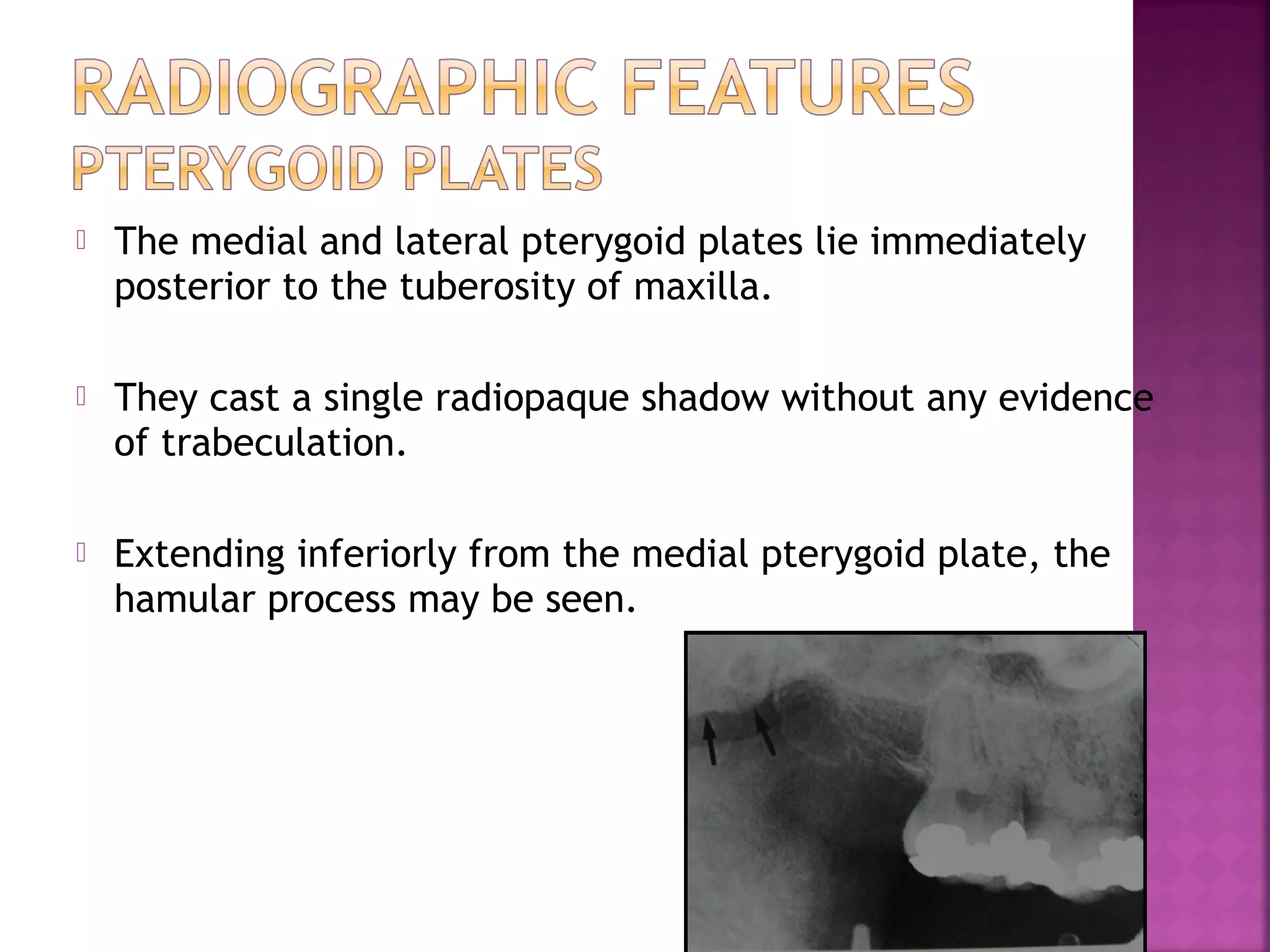 NORMAL ANATOMIC LANDMARKS ; PRICHARDS CRITERIA ; NORMAL INTERDENTAL ...