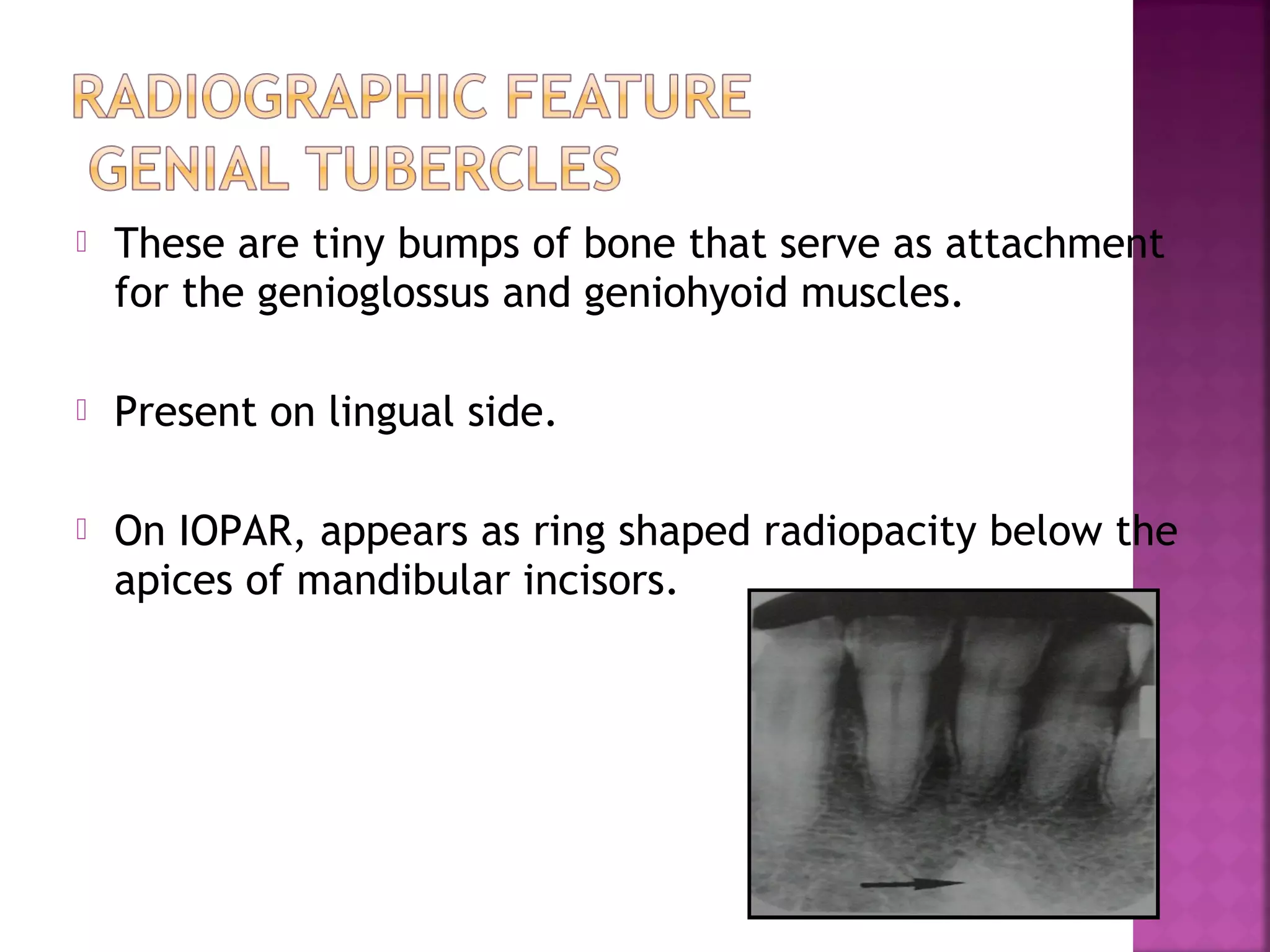 NORMAL ANATOMIC LANDMARKS ; PRICHARDS CRITERIA ; NORMAL INTERDENTAL ...