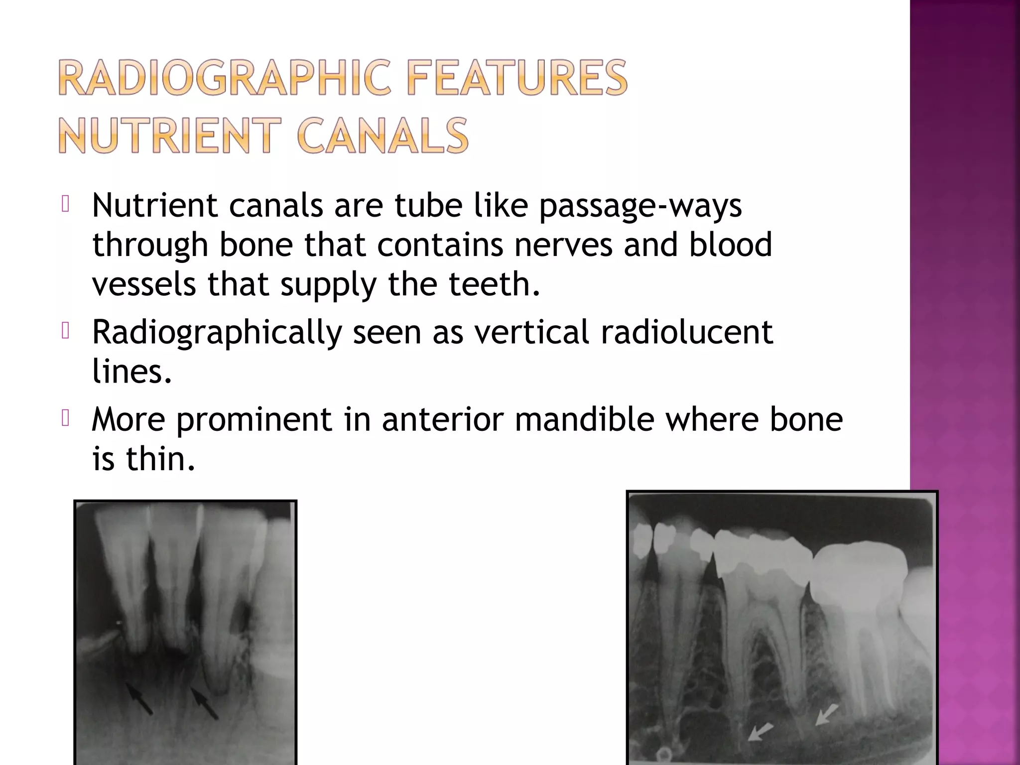 NORMAL ANATOMIC LANDMARKS ; PRICHARDS CRITERIA ; NORMAL INTERDENTAL ...