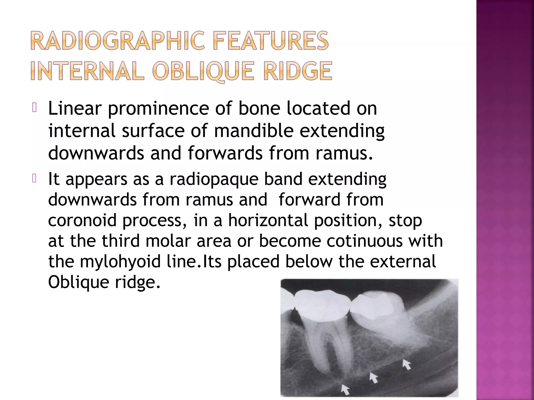 NORMAL ANATOMIC LANDMARKS ; PRICHARDS CRITERIA ; NORMAL INTERDENTAL ...