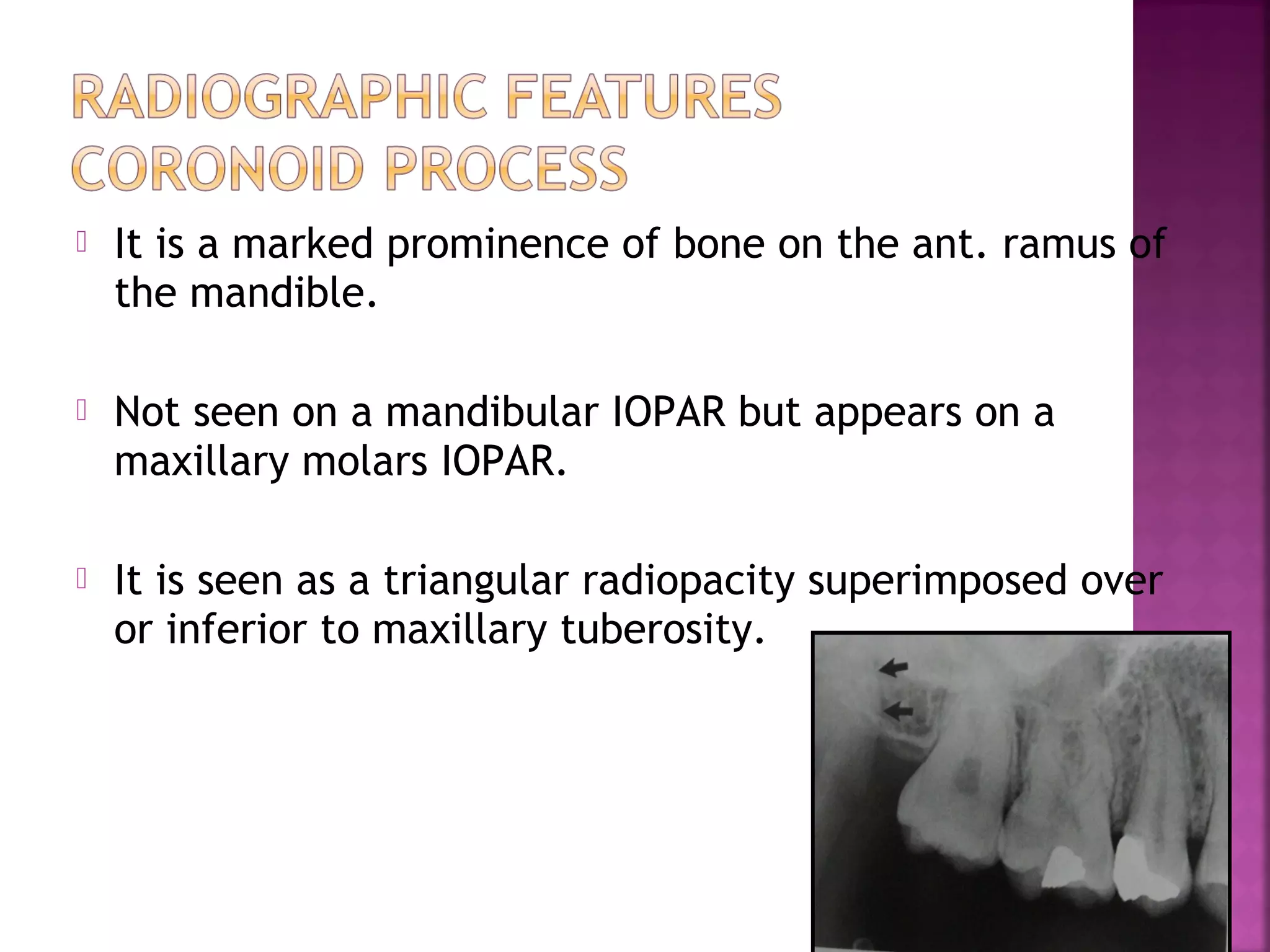 NORMAL ANATOMIC LANDMARKS ; PRICHARDS CRITERIA ; NORMAL INTERDENTAL ...