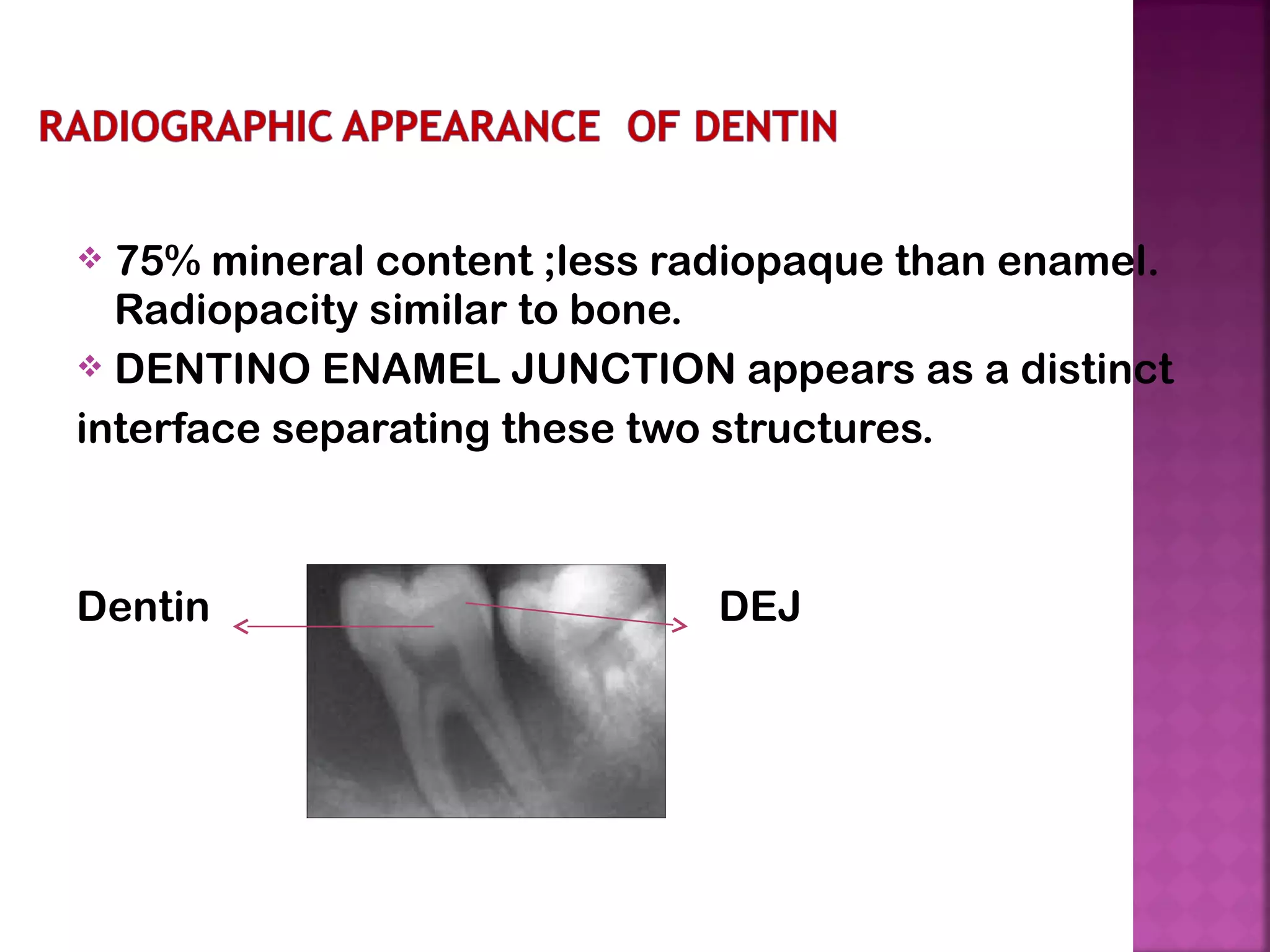 NORMAL ANATOMIC LANDMARKS ; PRICHARDS CRITERIA ; NORMAL INTERDENTAL ...