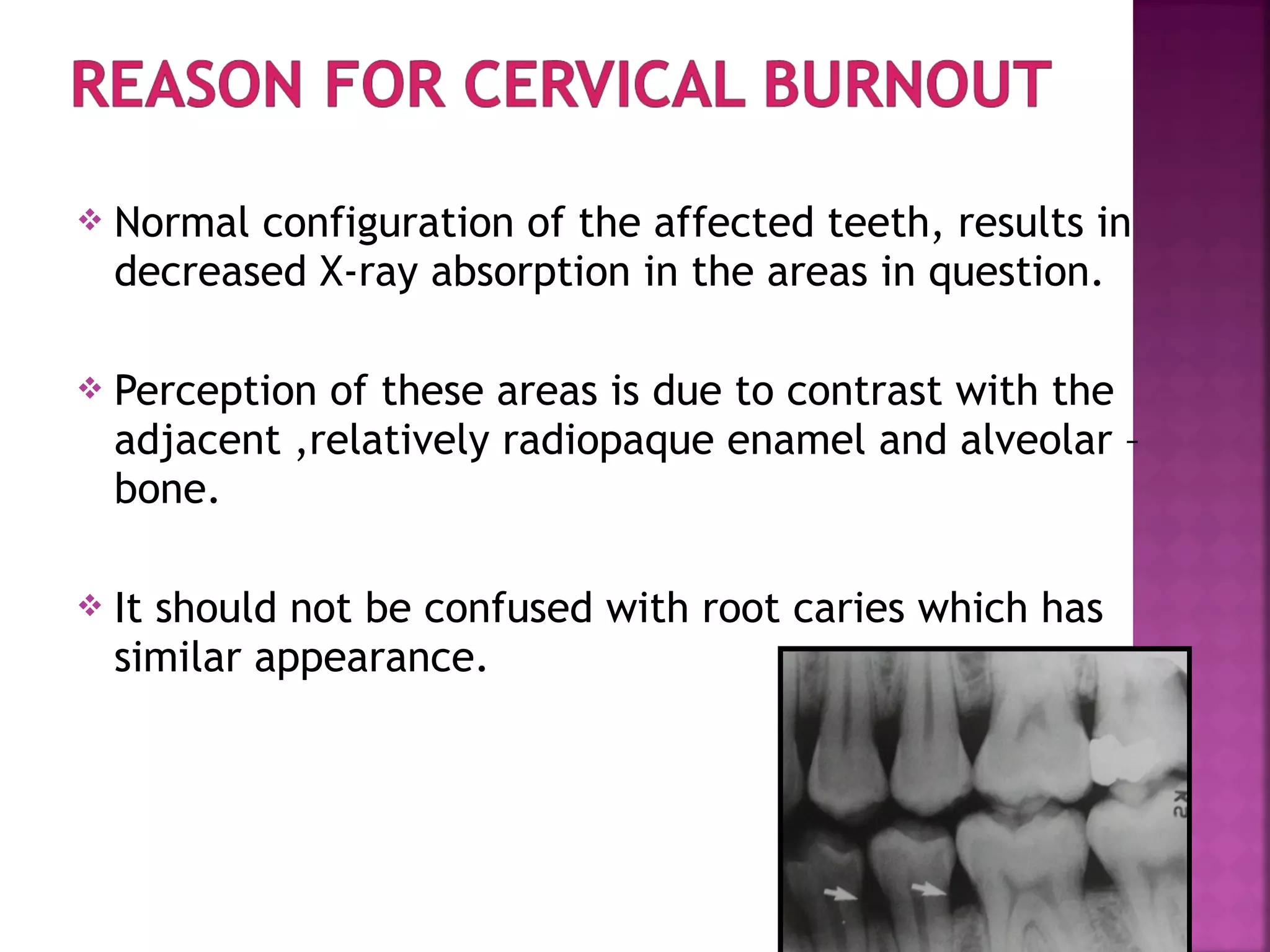 NORMAL ANATOMIC LANDMARKS ; PRICHARDS CRITERIA ; NORMAL INTERDENTAL ...