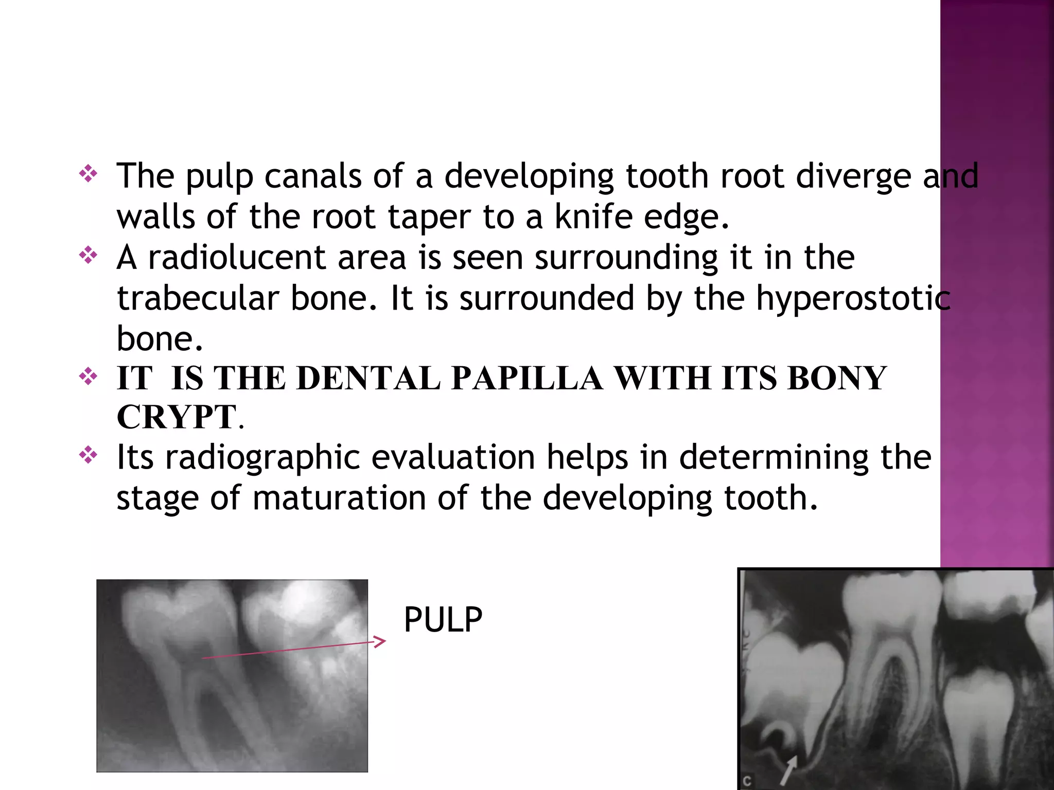 NORMAL ANATOMIC LANDMARKS ; PRICHARDS CRITERIA ; NORMAL INTERDENTAL ...