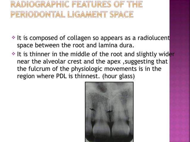 NORMAL ANATOMIC LANDMARKS ; PRICHARDS CRITERIA ; NORMAL INTERDENTAL ...